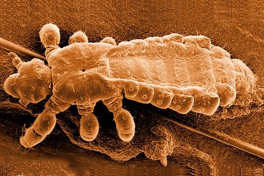 Kopfläuse & Nissen - Parasiten am Kopf ausfindig machen | NYDA®